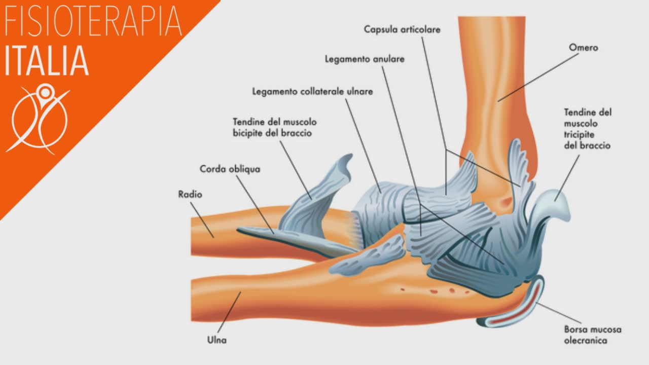 Epicondilite Gomito del Tennista Sintomi e Cure
