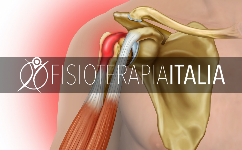 cuffia dei rotatori, patologia e cura