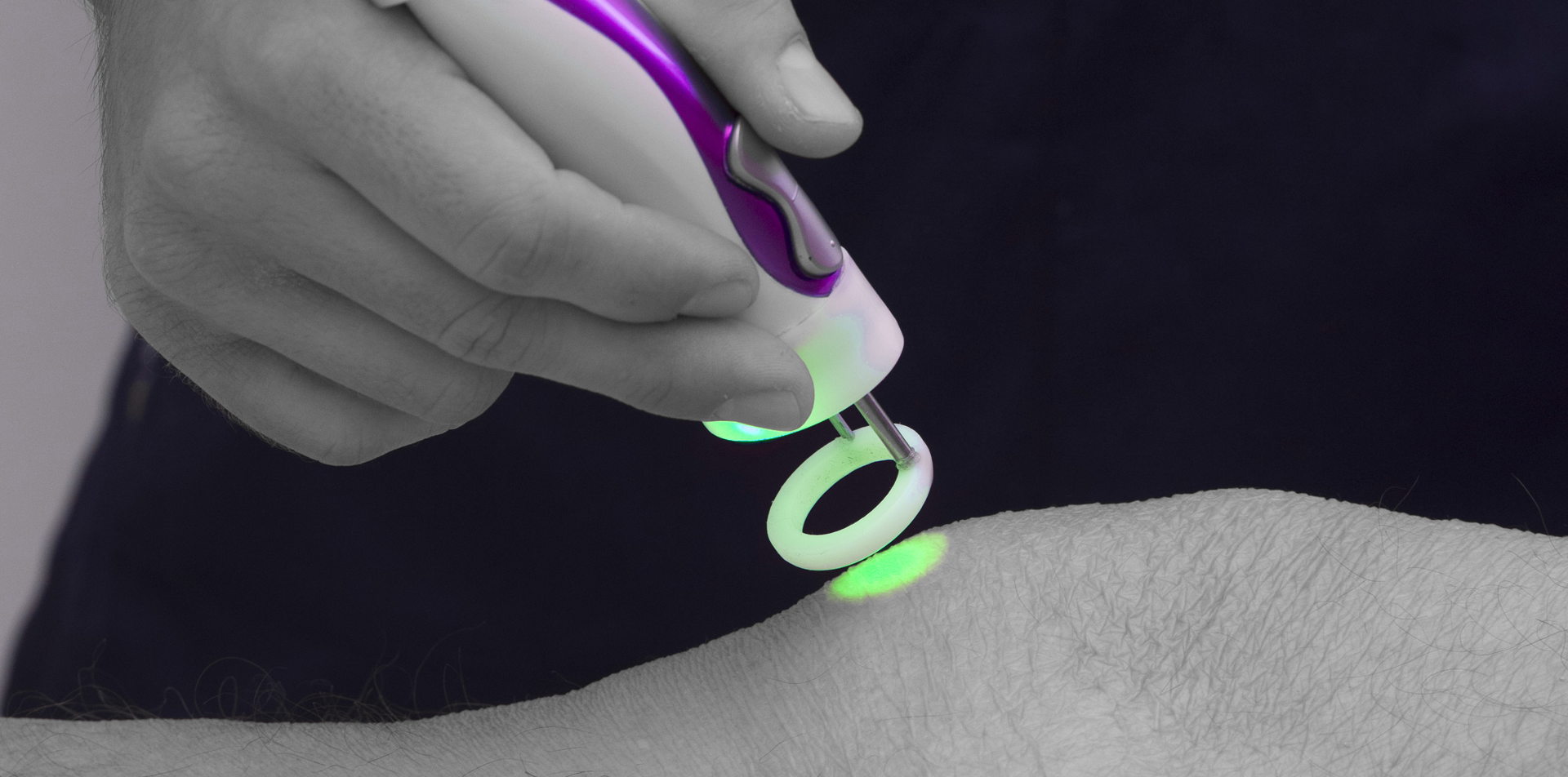 Laserterapia applicazioni terapeutiche in fisioterapia
