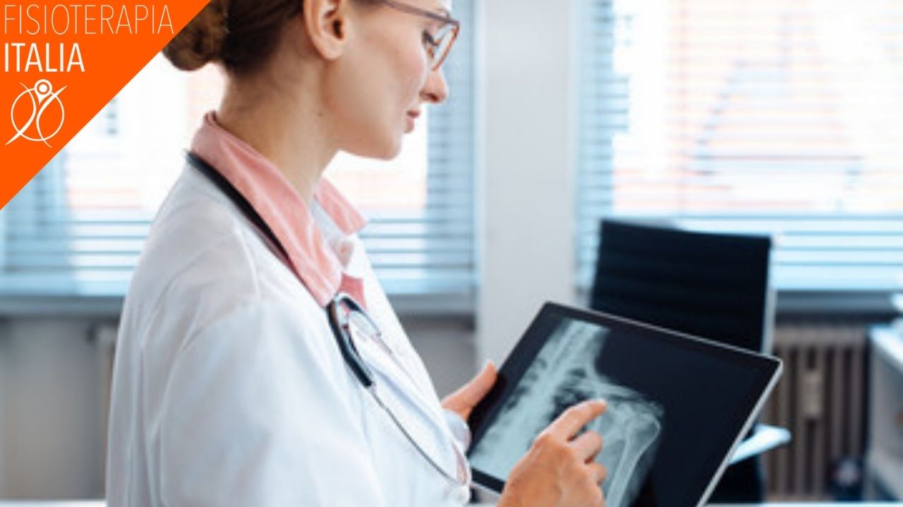 Borsite alla spalla cos'è e come si cura con la fisioterapia